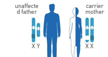 Mucopolysaccharidosis Type II (MPS II) in Latin America